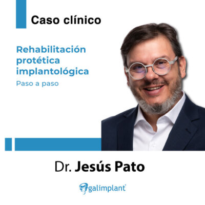 Jesús Pato - Galimplant